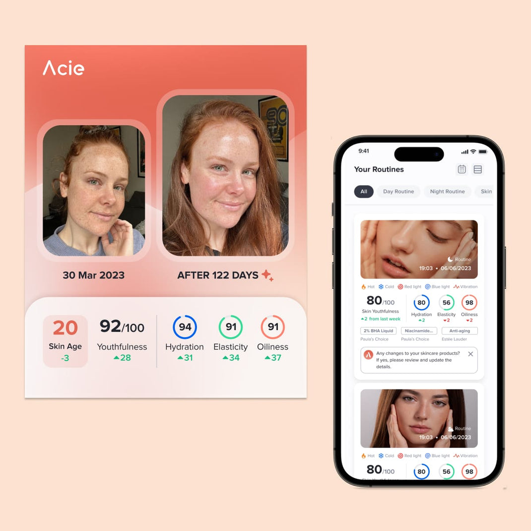 World's first AI Skincare Device with Built-in Capsules and Analyzer – Acie