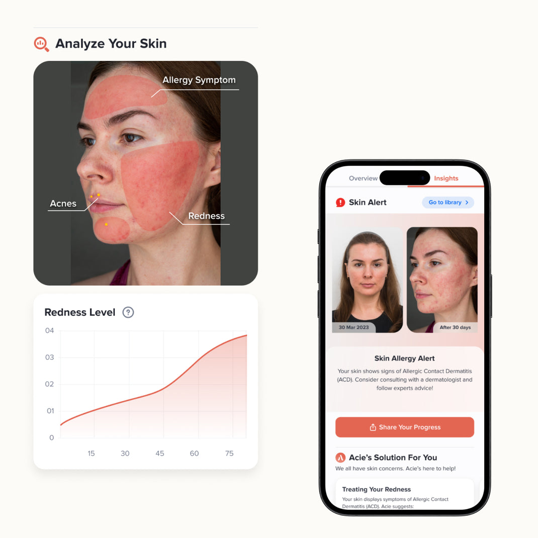 World's first AI-powered skin-sensing device for everyday use – Acie